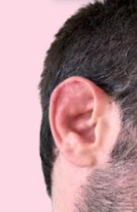 How Long Does It Take to Get Cauliflower Ear from BJJ? How Common Is It ...